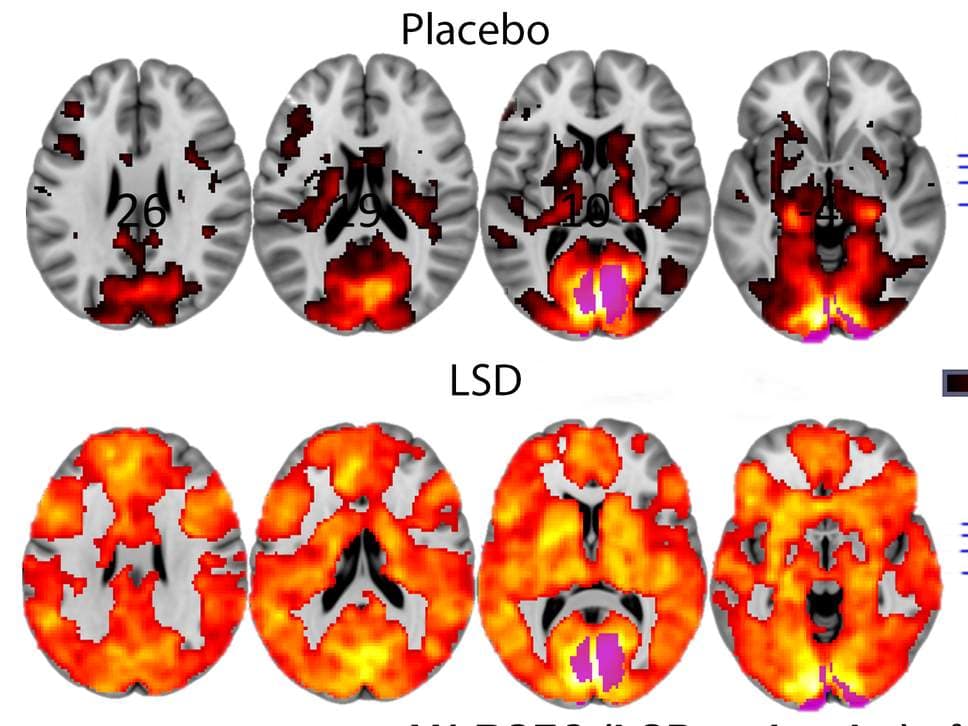 חוברת חוקרים - LSD - MAPS 2008 - שון לייקוב